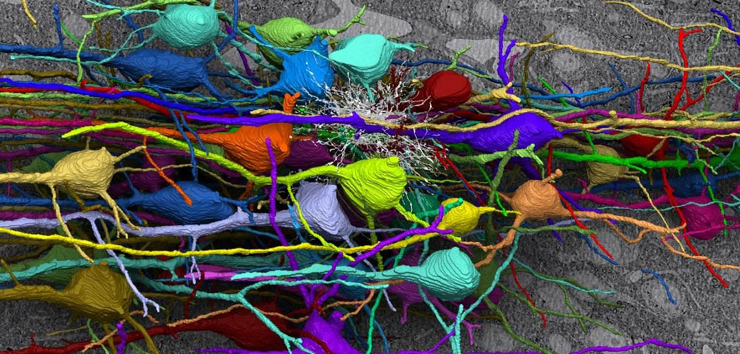 Enhancing neuroplasticity: Study suggests physical activity makes it ... Enhancing neuroplasticity: Study suggests physical activity makes it ...