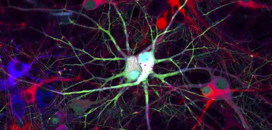 First Look At How Astrocytes Function In Humans