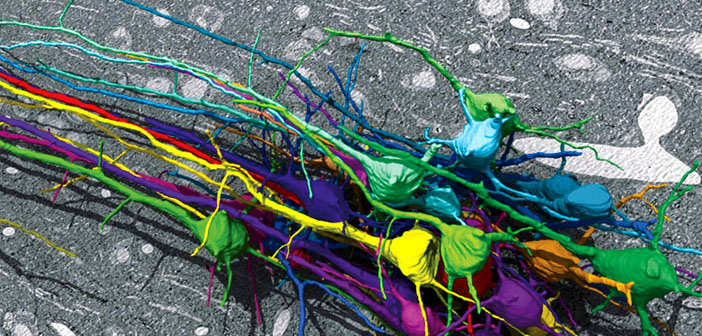 Inside the adult ADHD brain