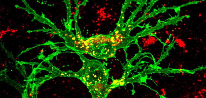 Remyelination: How an FDA-approved drug boosts myelin synthesis