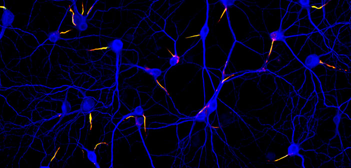 Broken signals lead to neurodegeneration