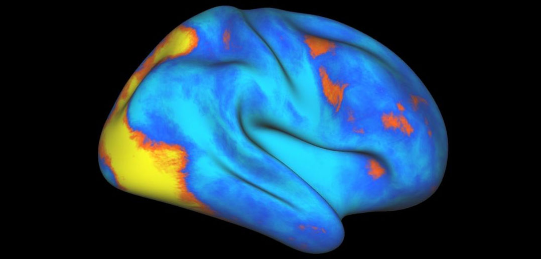Distinct stages of thinking revealed by brain activity patterns