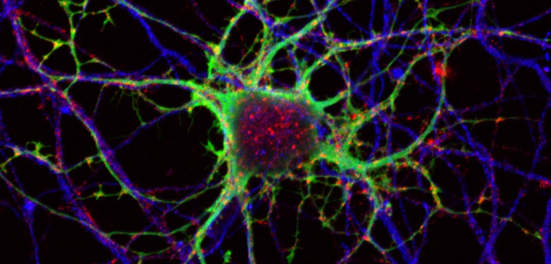 Newly described ion channel structure reveals how excited neurons ...