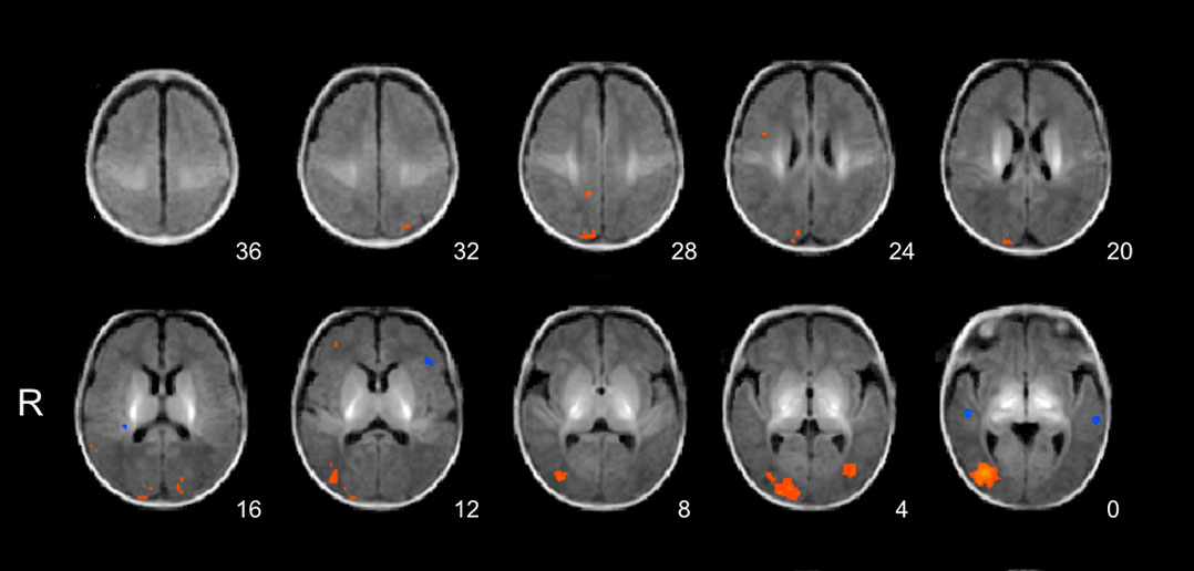 Brain activity map reveals how infant vision develops in the 7-week-old ...