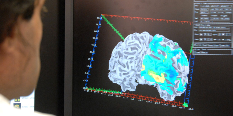 Using machine-learning systems to predict changes in the Alzheimer's brain