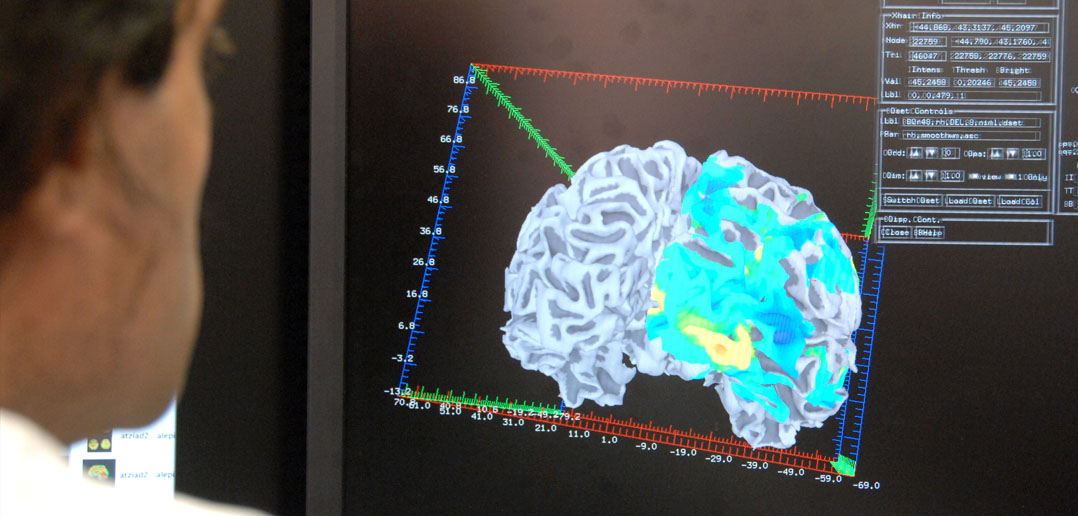 Using machine-learning systems to predict changes in the Alzheimer&#039;s brain