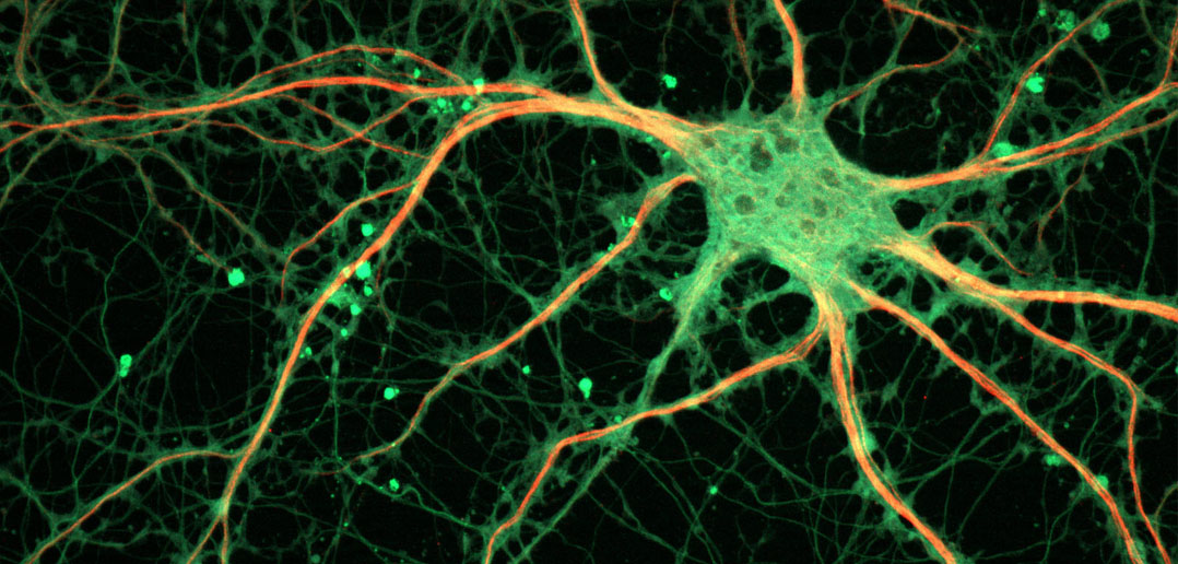 A common brain cell shapes the nervous system in unexpected ways