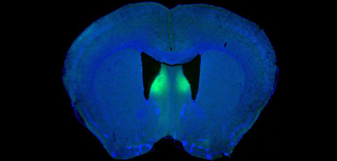 Origins of 'rage' identified in brain in male animal model