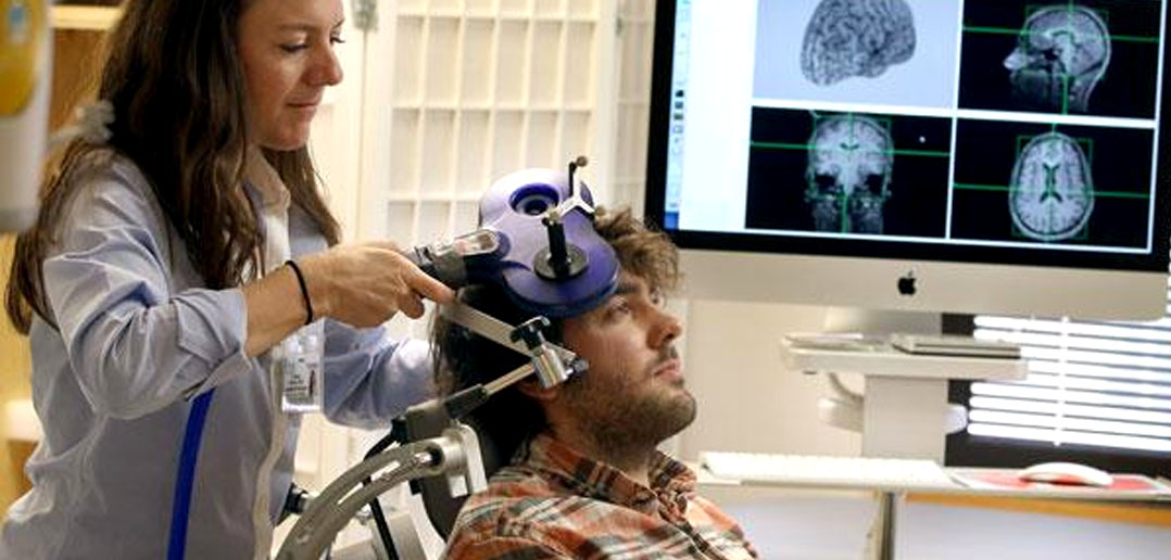 Transcranial Direct Current Stimulation