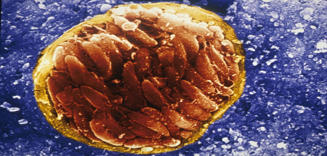Toxoplasma Gondii infection: Does this parasitic disease alter the ...