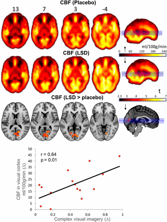 The brain on LSD revealed: First scans show how the drug affects the brain