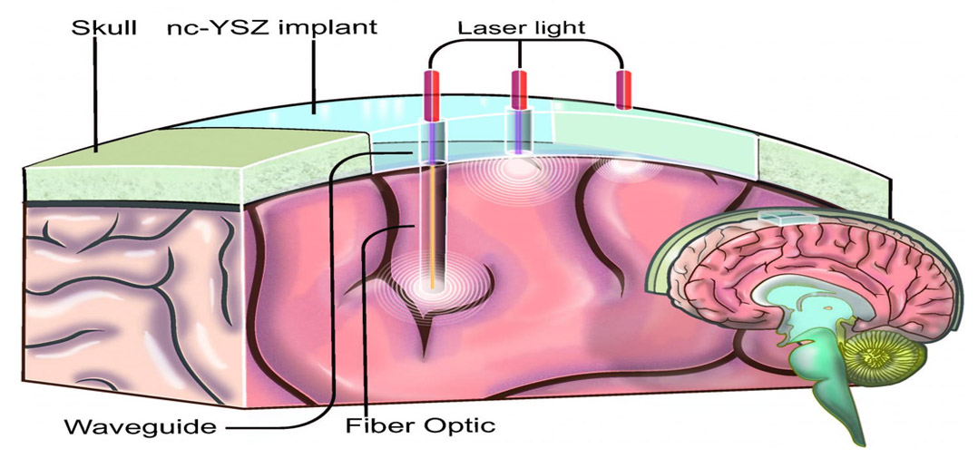 Scientists move closer to developing therapeutic window to the brain