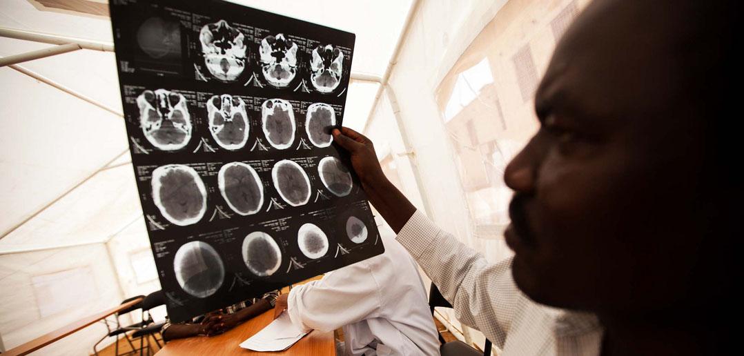 Brain network of psychopathic criminal functions differently