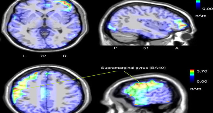 EEG study finds the human brain is deeply sexist when it comes to ...