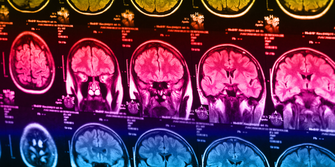 Borderline Understanding My Borderline Personality Disorder Life Stories