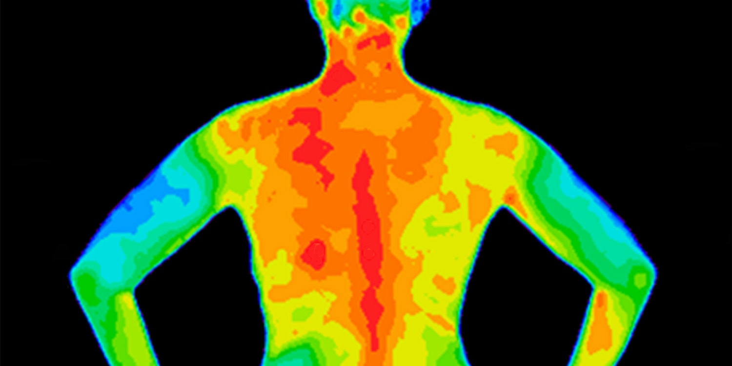 People experiencing manic episodes have measurably higher skin temperatures